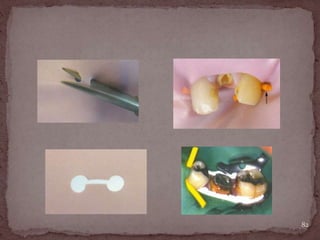 Isolation Of Dental Operating Field | PPTX