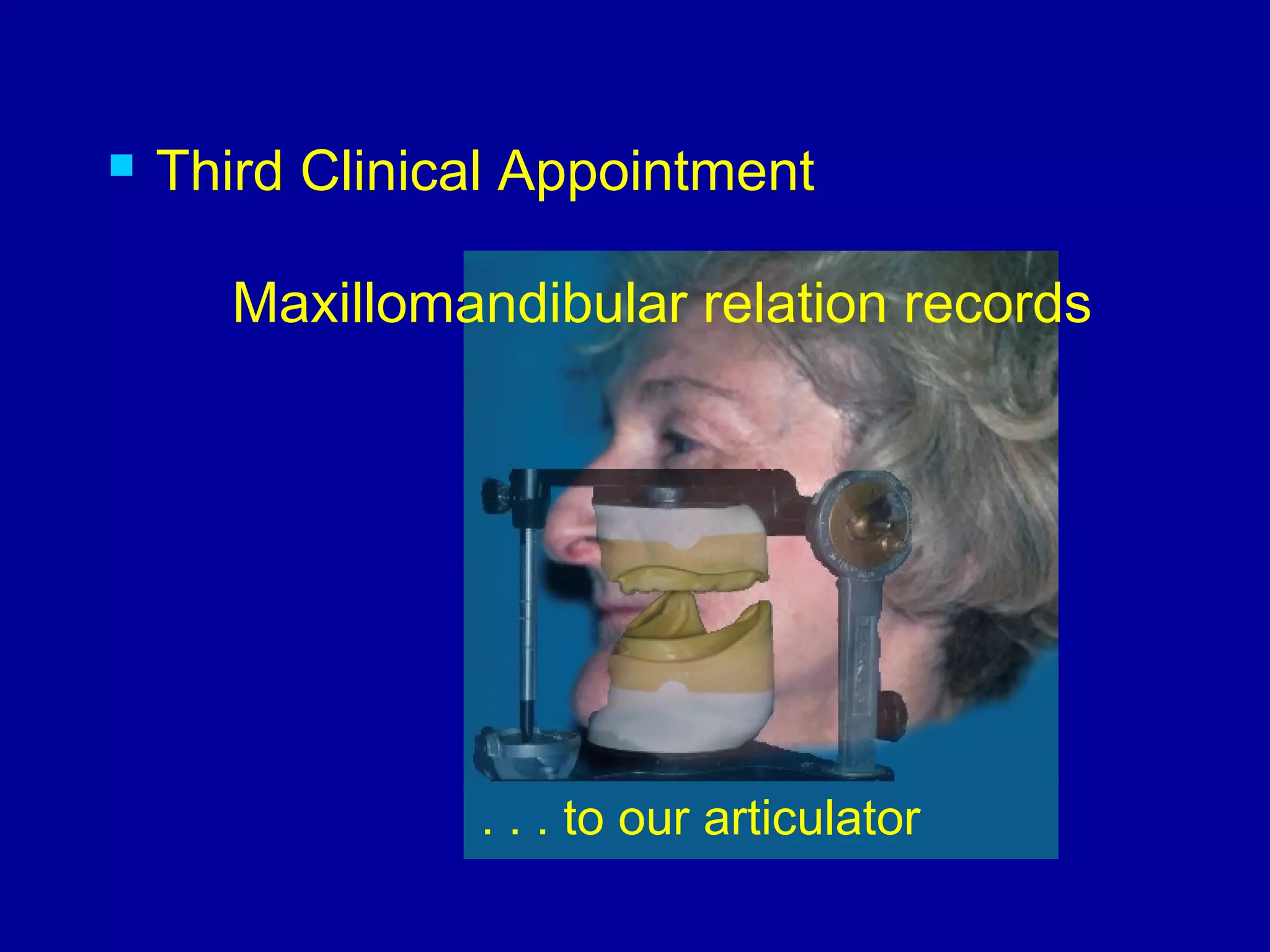 record bases & occlusal rims | PPT