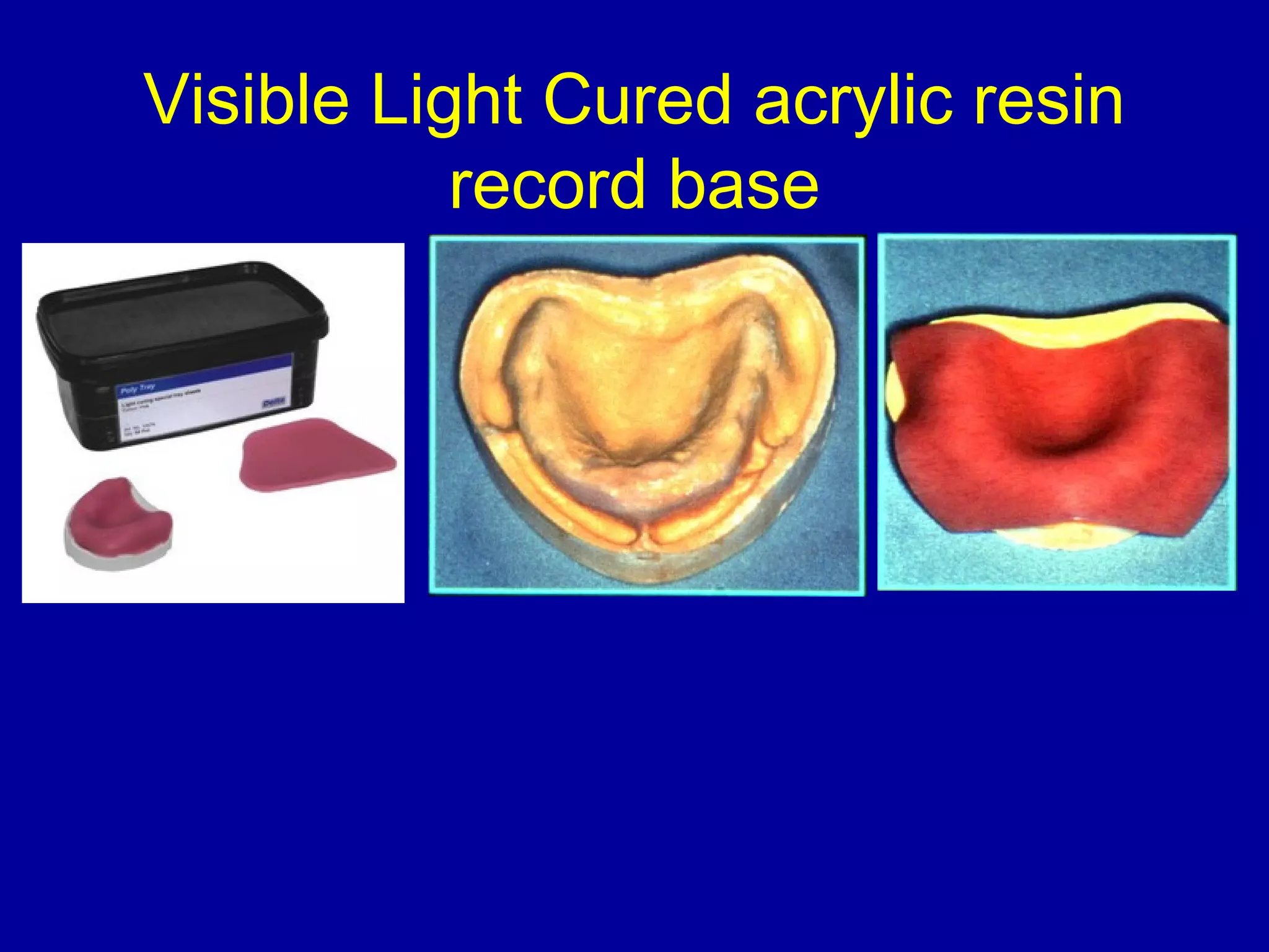 record bases & occlusal rims | PPT