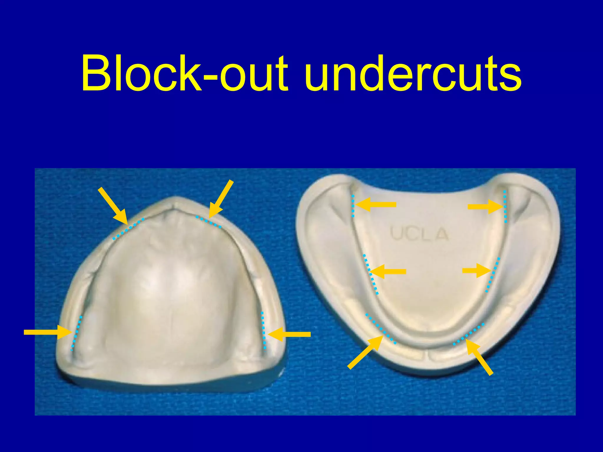 record bases & occlusal rims | PPT