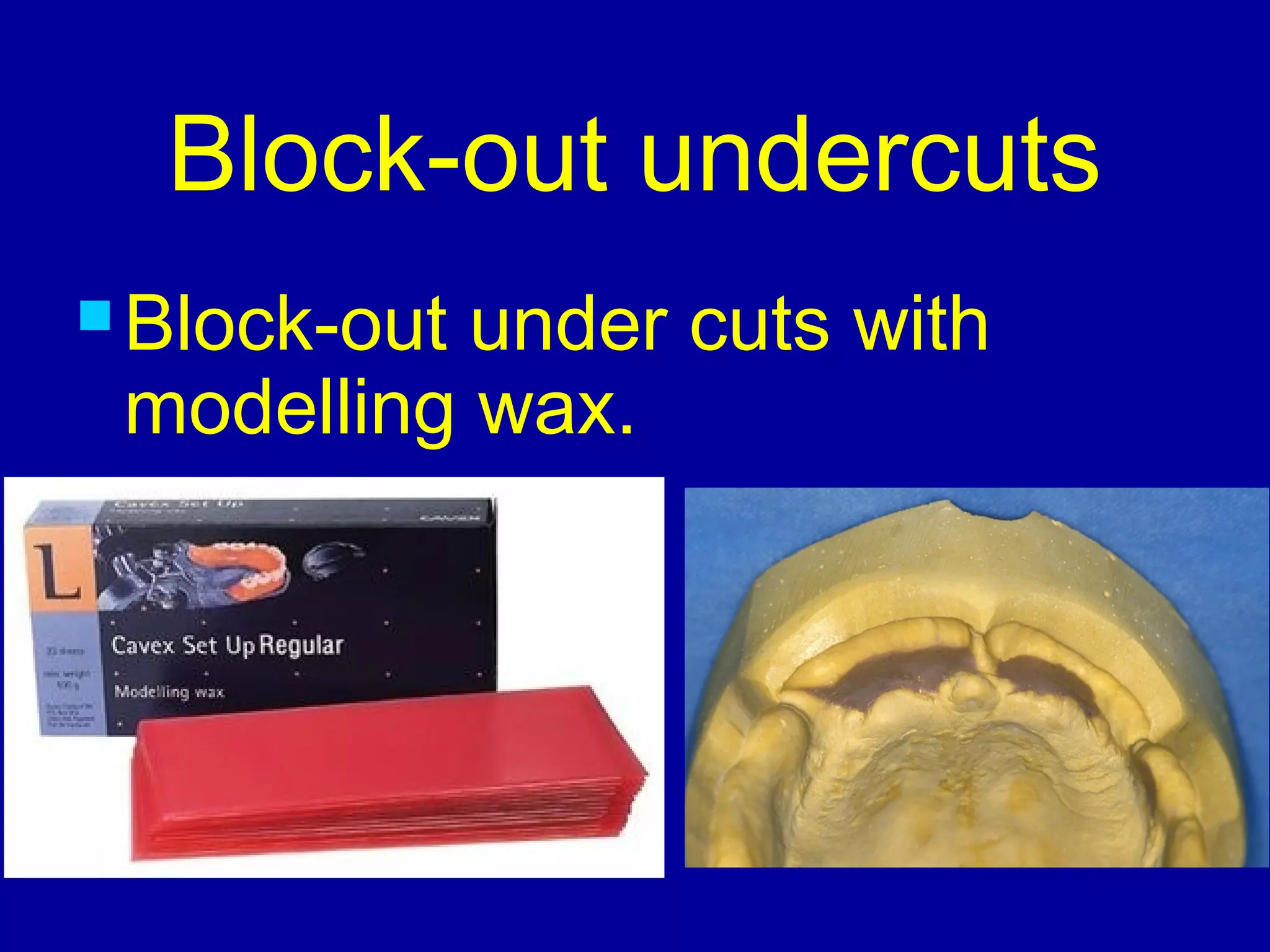 record bases & occlusal rims | PPT