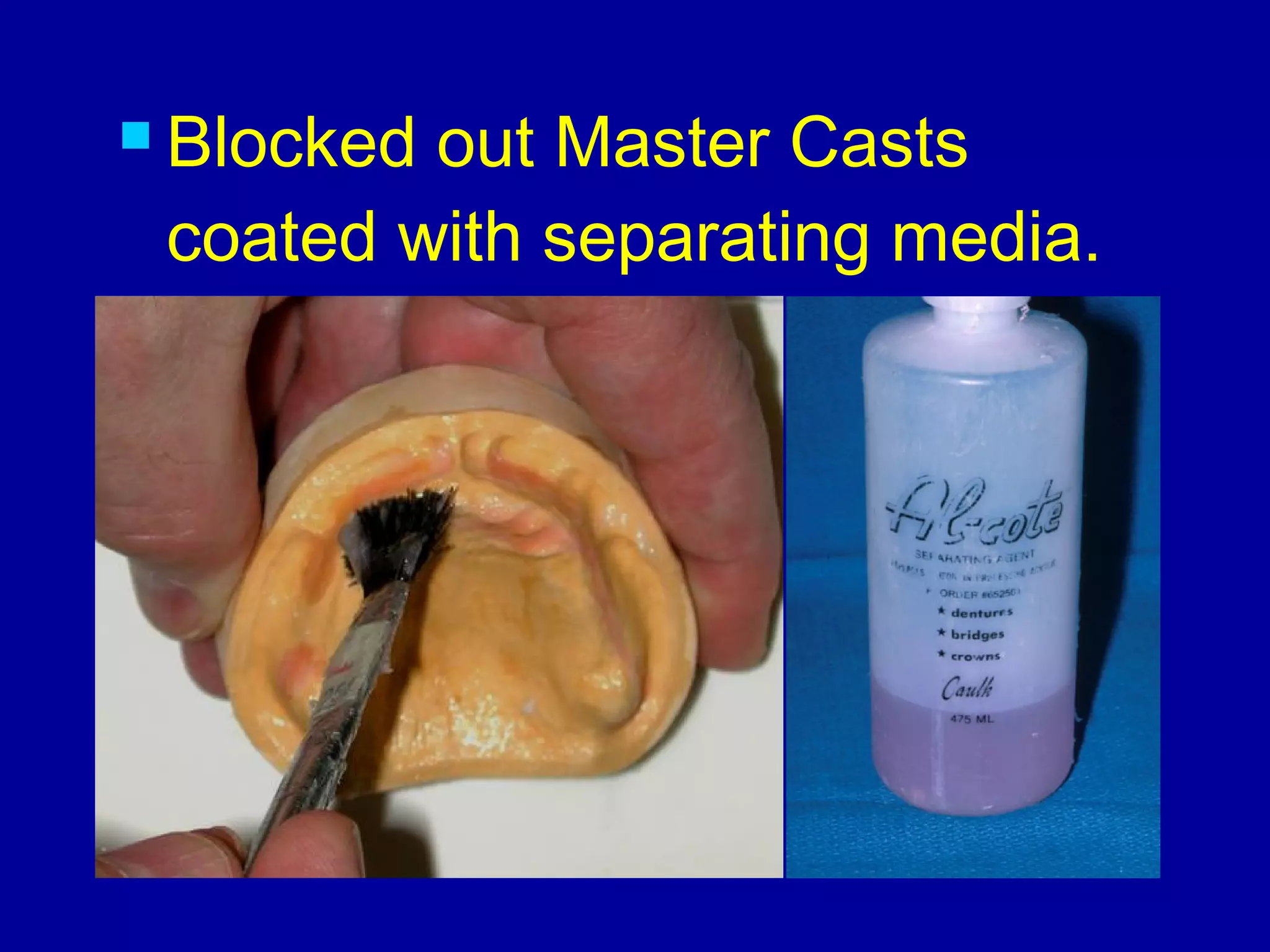 record bases & occlusal rims | PPT
