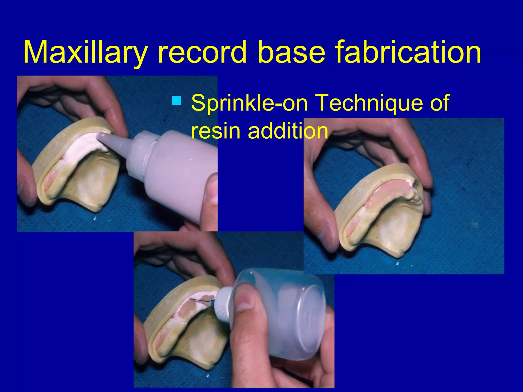 record bases & occlusal rims | PPT