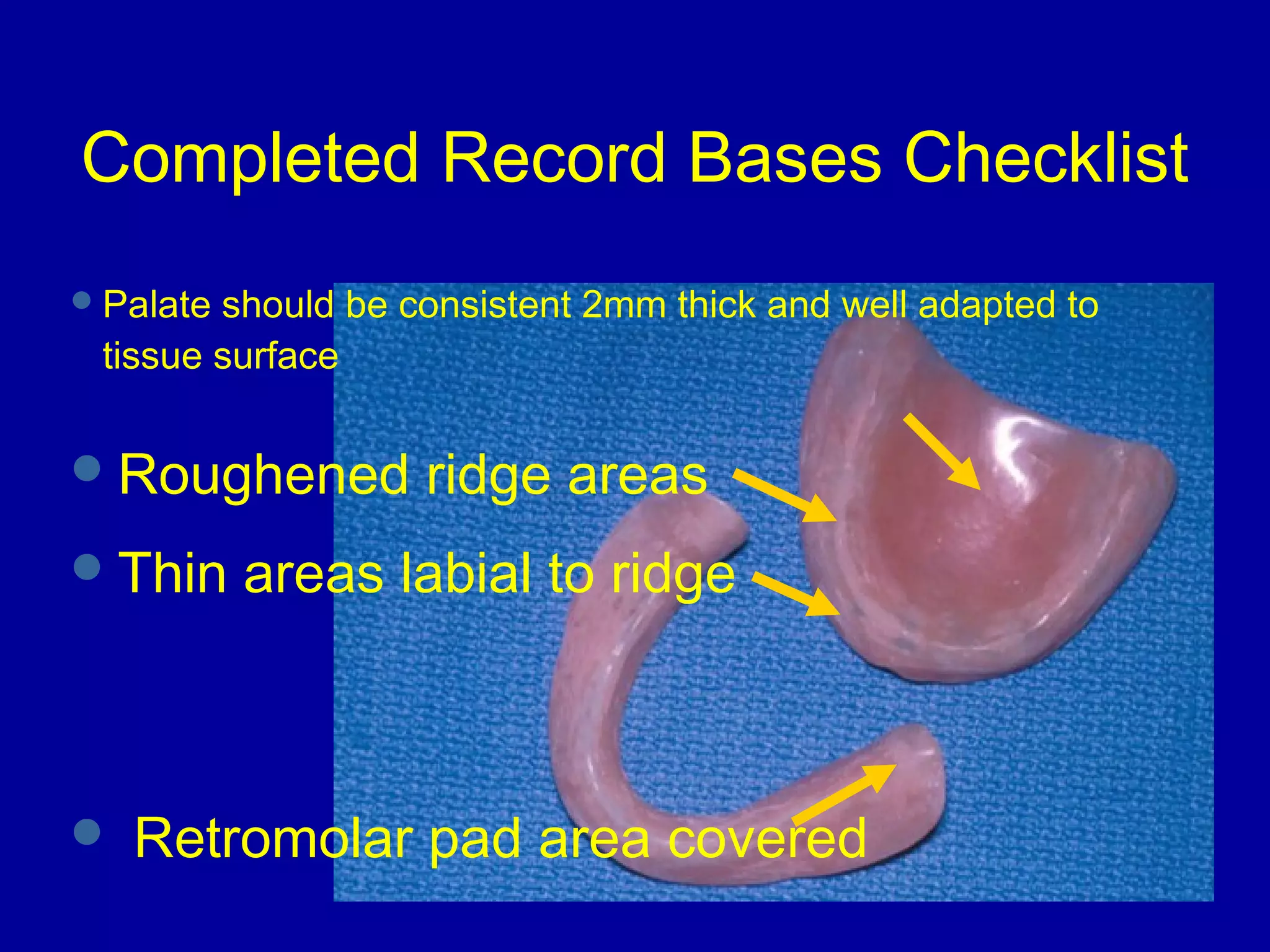 record bases & occlusal rims | PPT