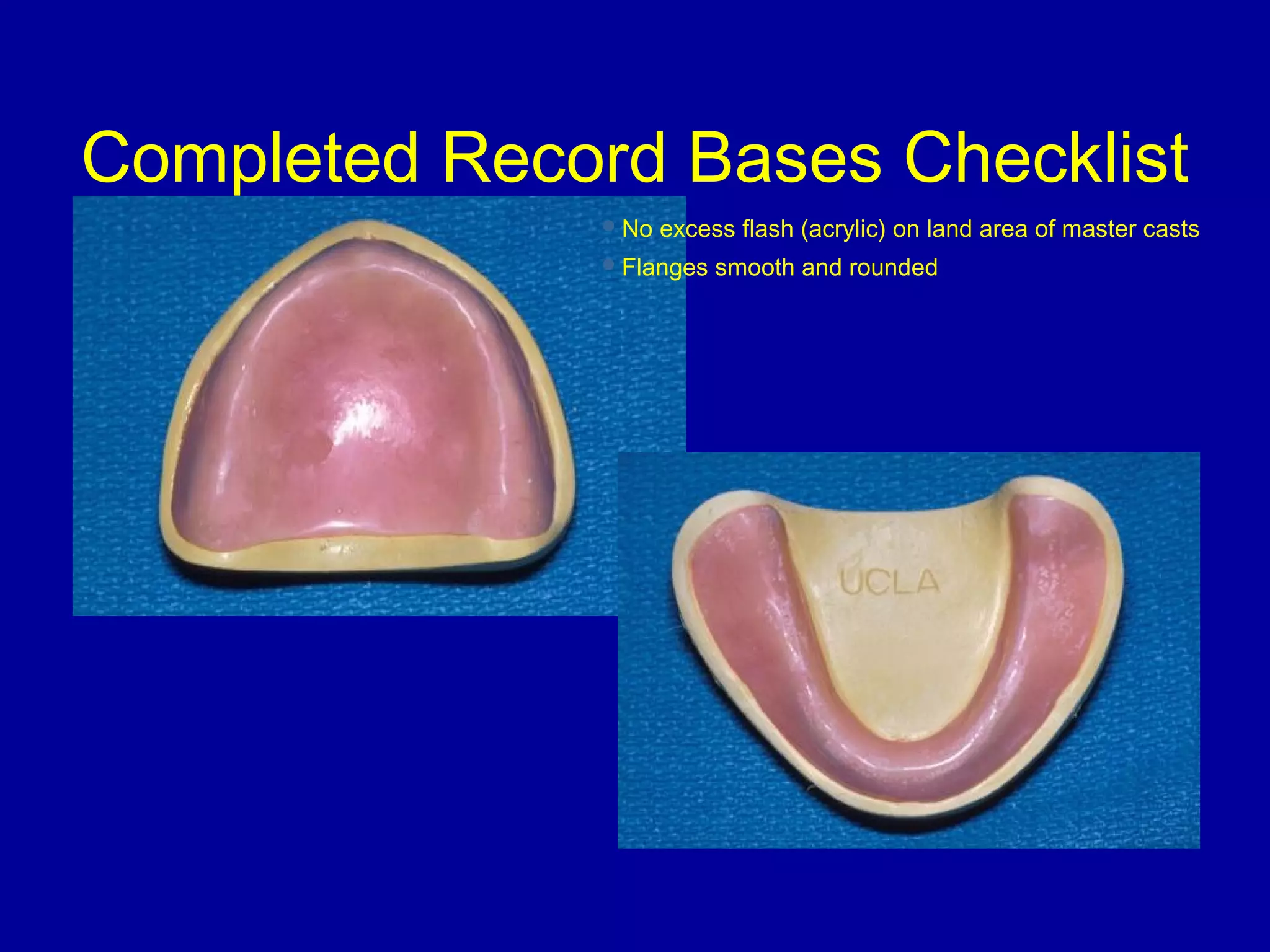 record bases & occlusal rims | PPT