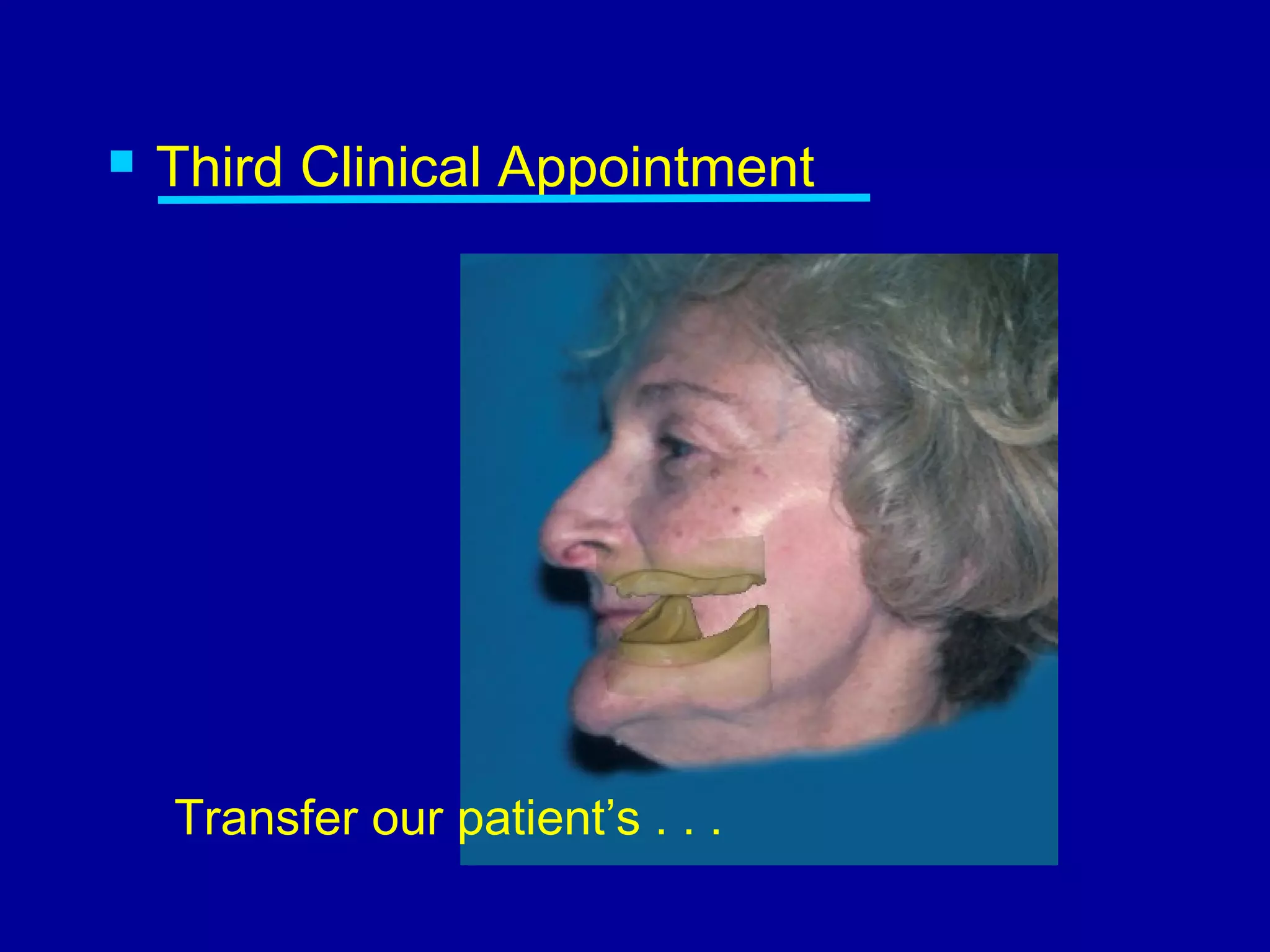 record bases & occlusal rims | PPT