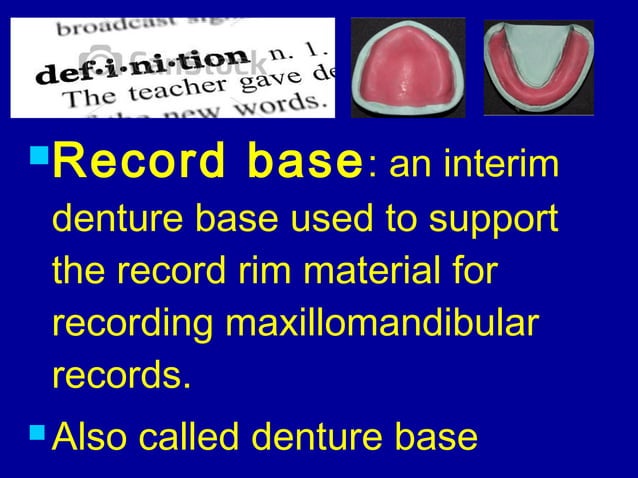 record bases & occlusal rims | PPT