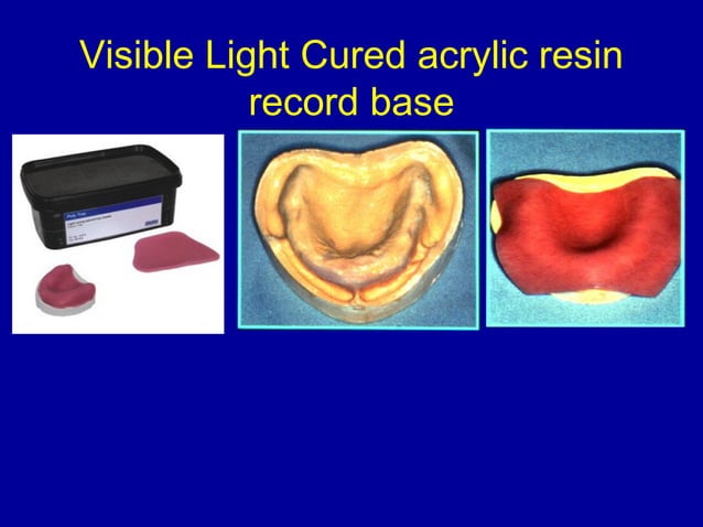 record bases & occlusal rims | PPT