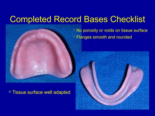 record bases & occlusal rims | PPT