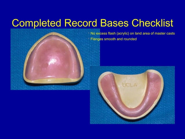 record bases & occlusal rims | PPT