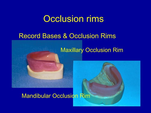 record bases & occlusal rims | PPT
