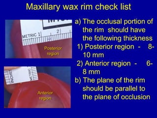 record bases & occlusal rims | PPT