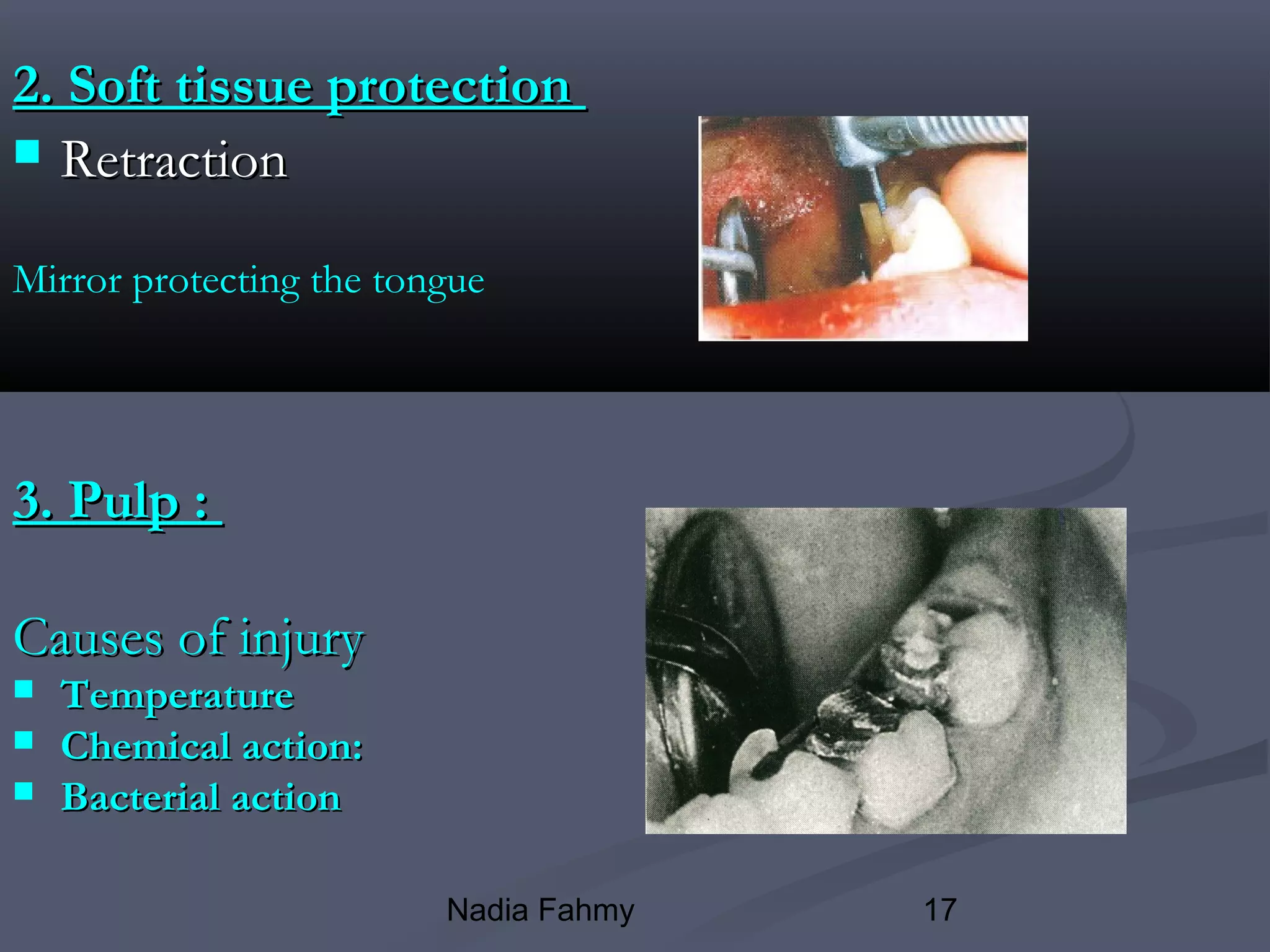 5.biologic considerations in fixed restorations 2013 | PPT