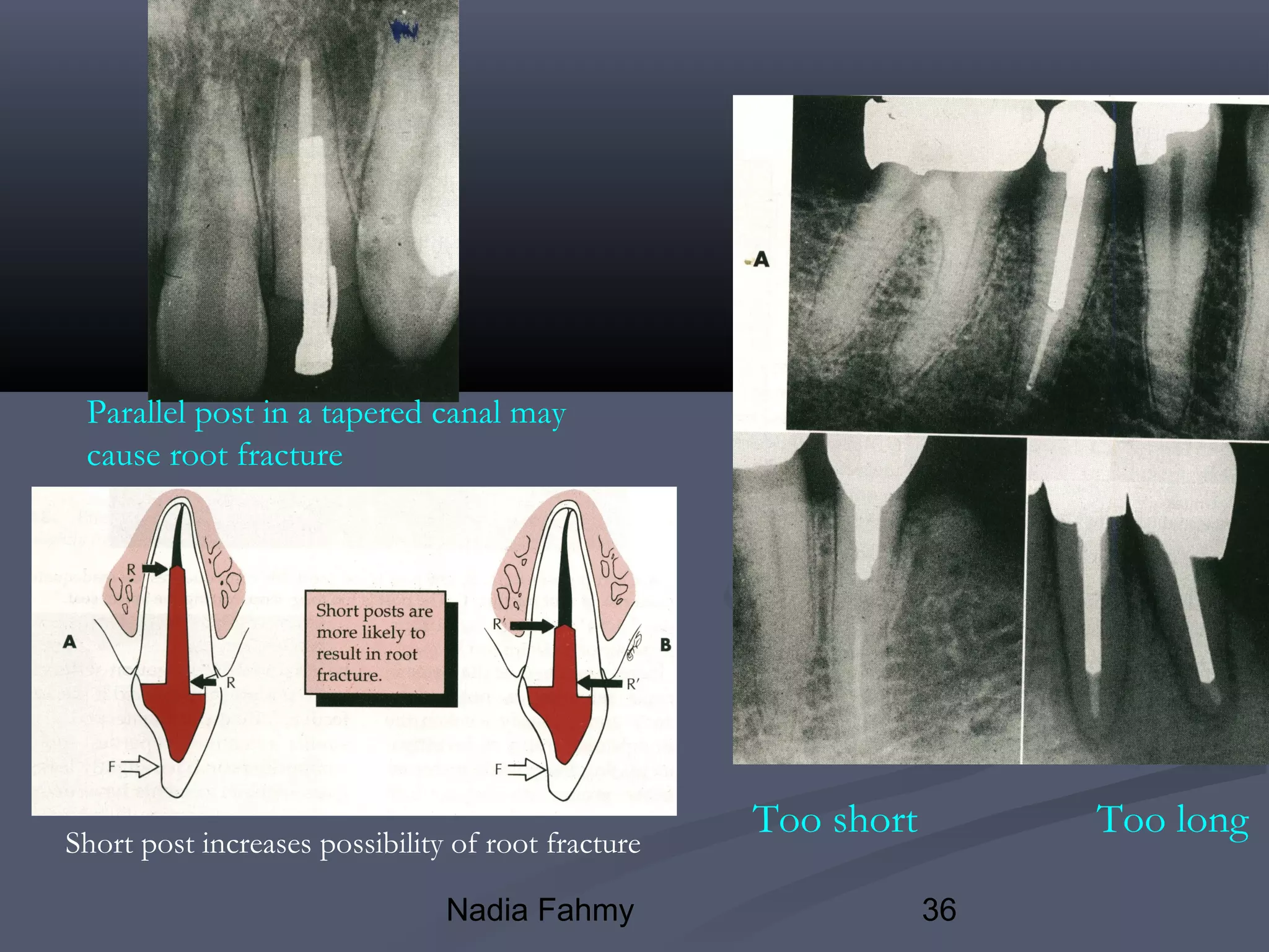 5.biologic considerations in fixed restorations 2013 | PPT