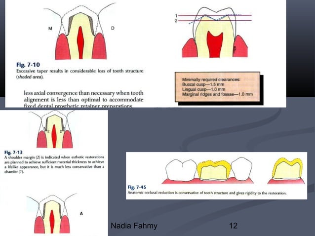 5.biologic considerations in fixed restorations 2013 | PPT | Dental ...
