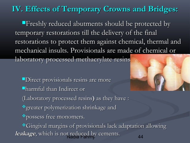 5.biologic considerations in fixed restorations 2013 | PPT | Dental ...