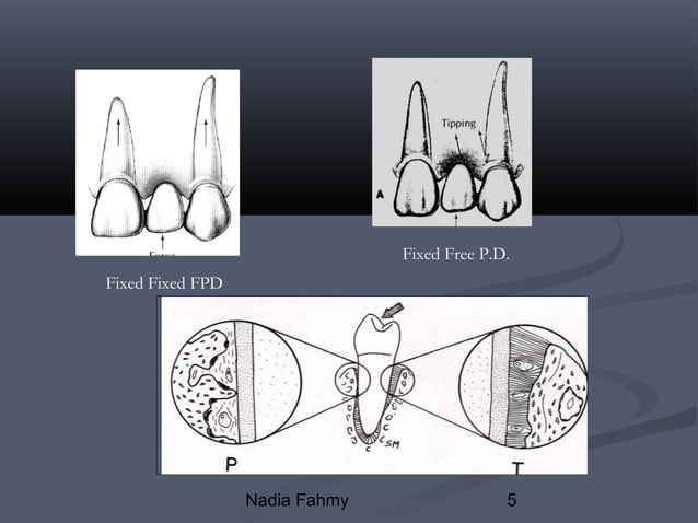 5.biologic considerations in fixed restorations 2013 | PPT | Dental ...