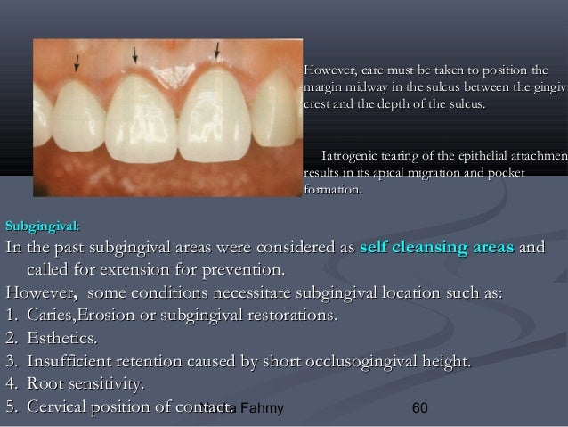 5.biologic considerations in fixed restorations 2013