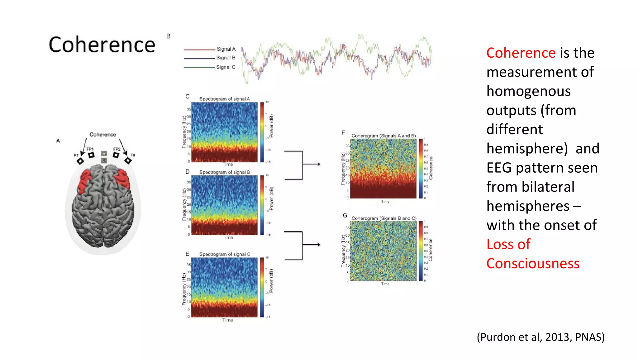 5. thomas lew how anaesthetic works (and why knowing matters) | PPT
