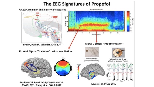 5. thomas lew how anaesthetic works (and why knowing matters) | PPT