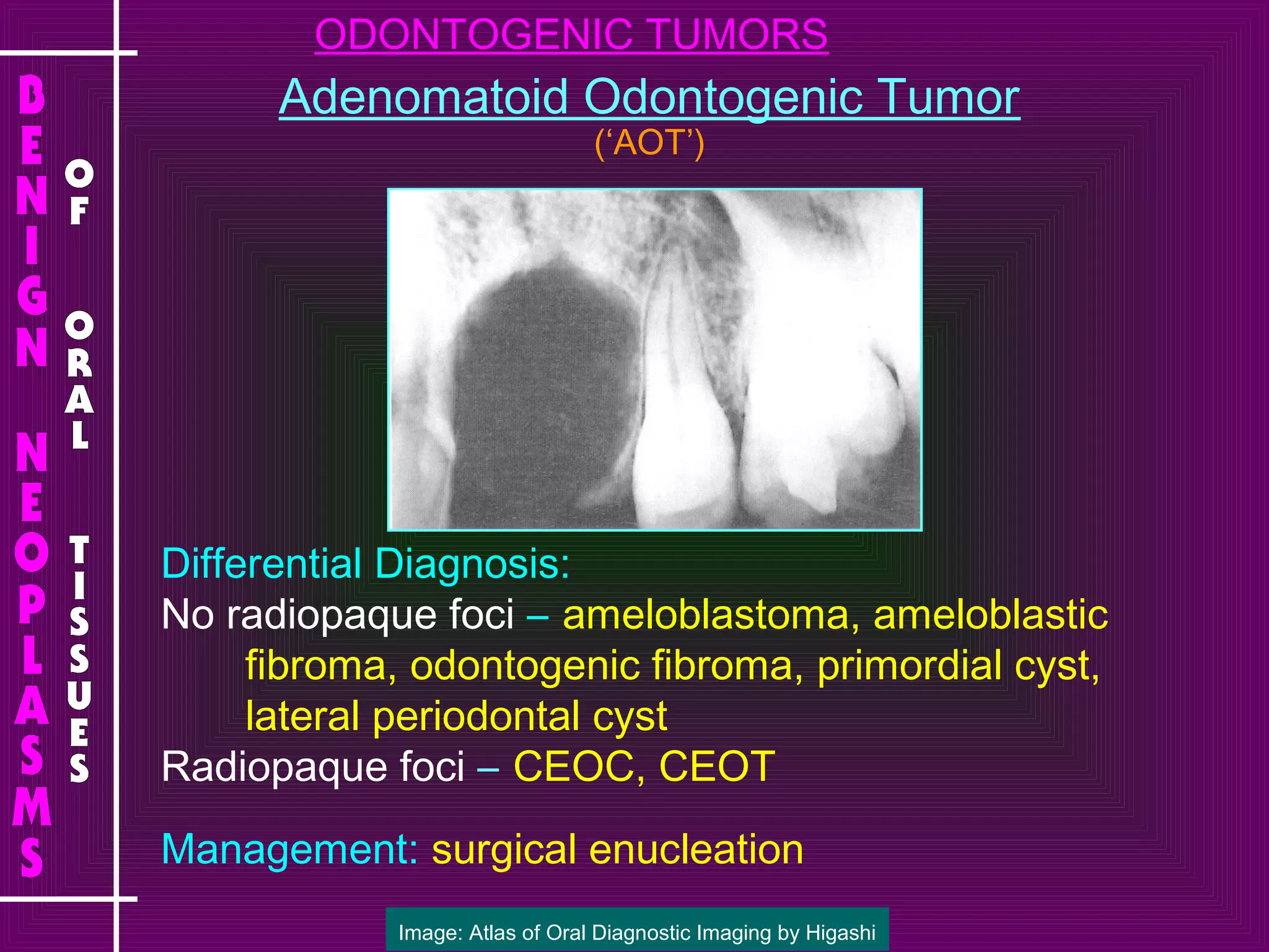 5. odontogenic tumor (1) | PPT