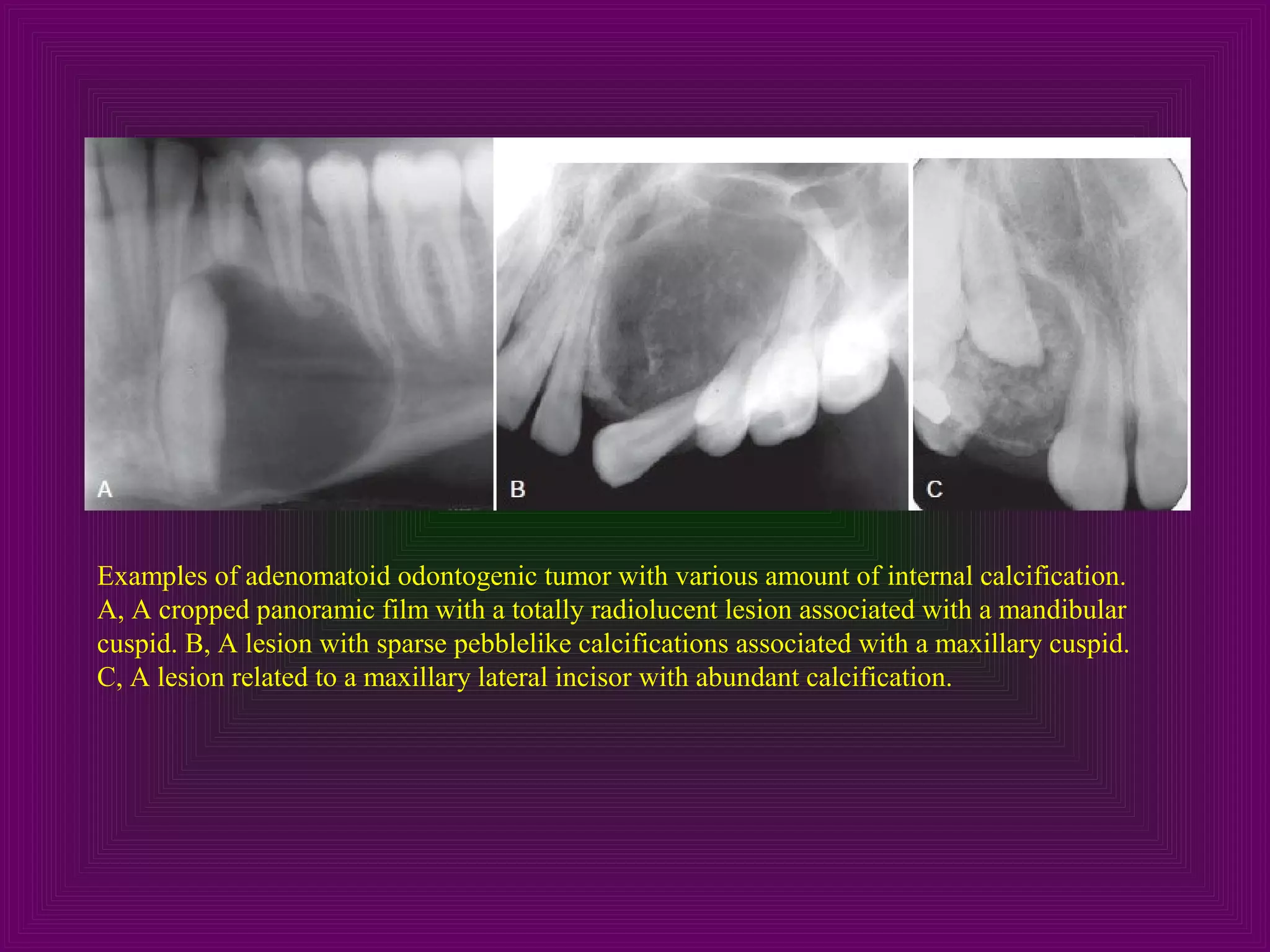 5. odontogenic tumor (1) | PPT