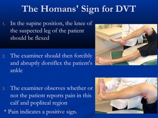 pulmonary embolism | PPT