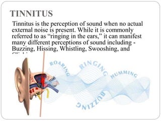 Tinnitus and It's Treatment | PPTX
