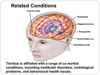Tinnitus and It's Treatment | PPT