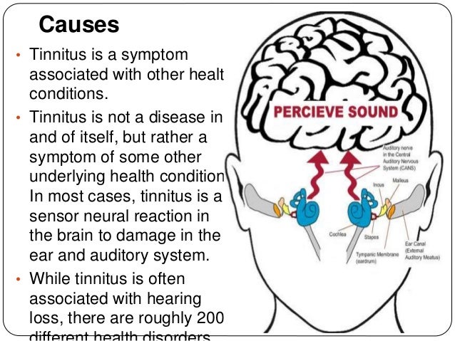Tinnitus and It's Treatment