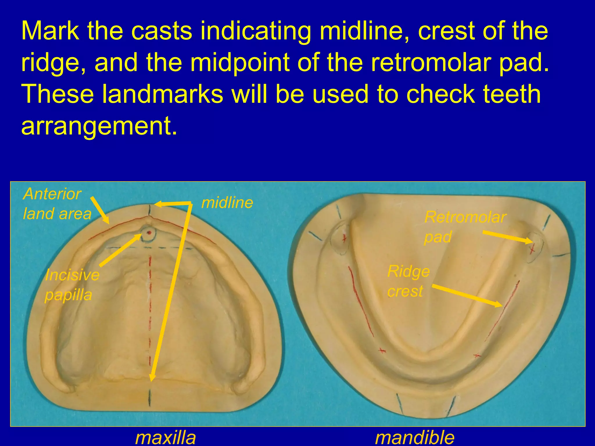 5. hand out | PPT