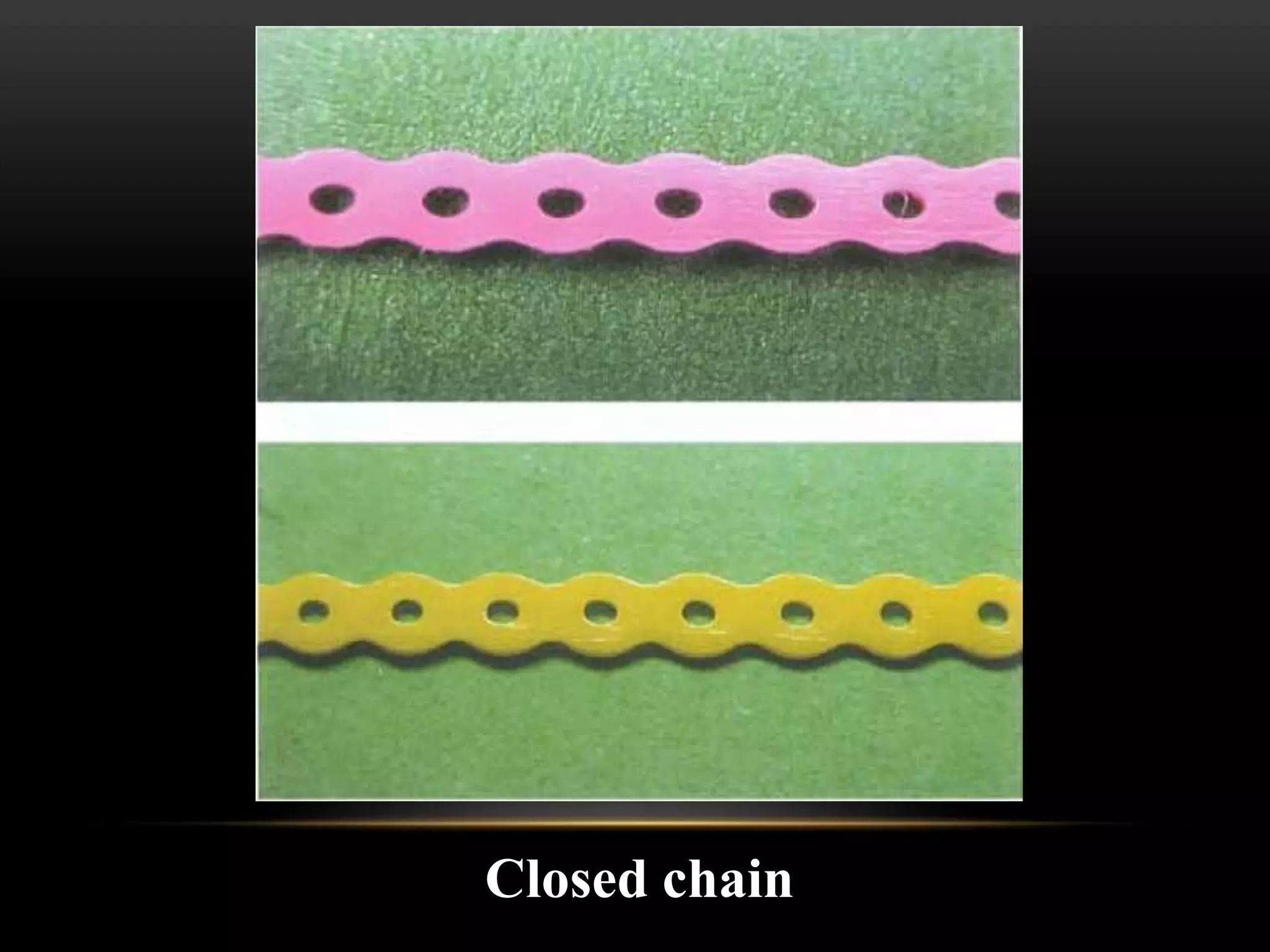 Space closure in orthodontics by elastics | PPTX