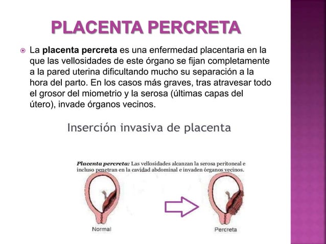 5.placenta acreta y percreta | PPT