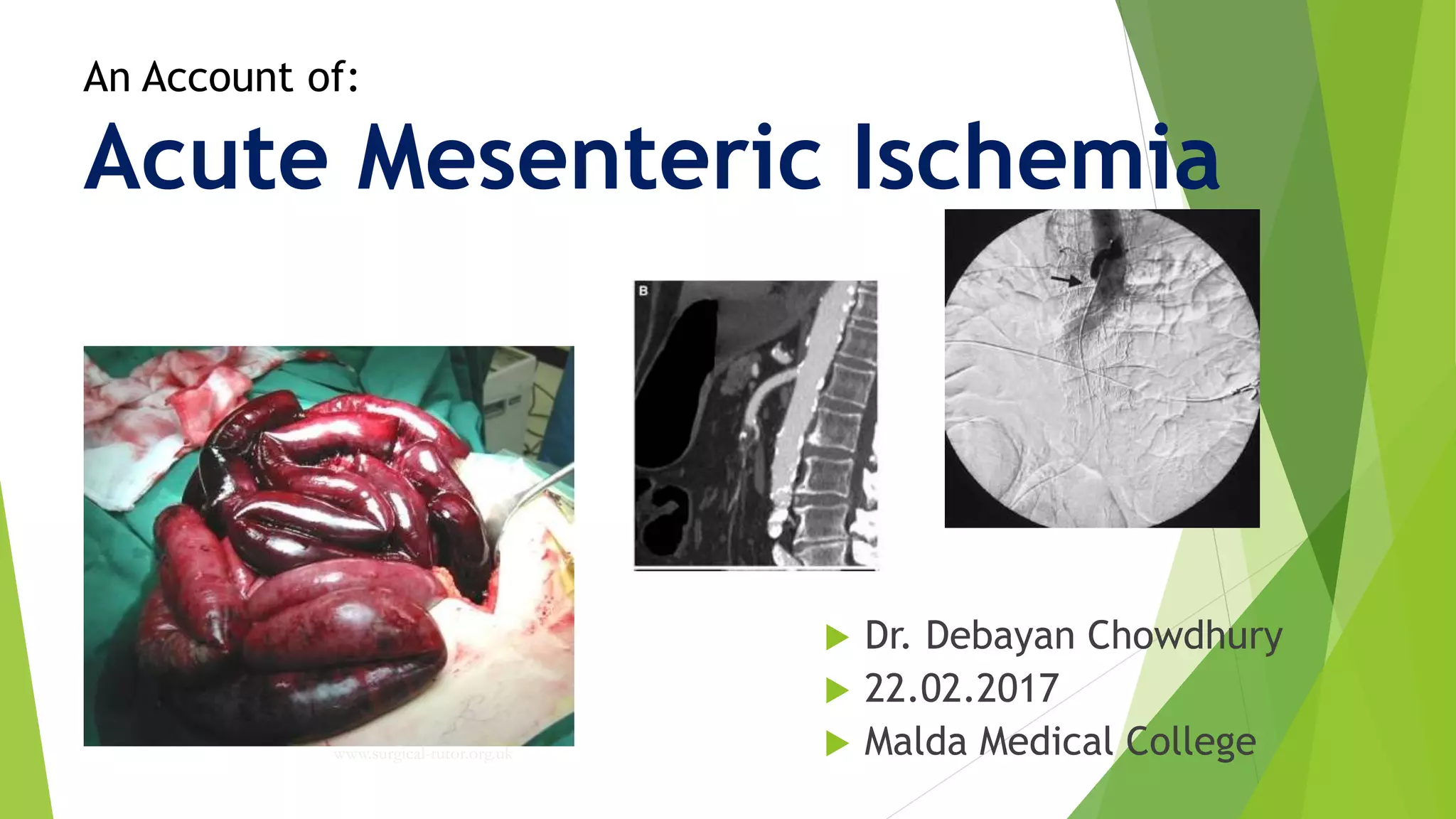 ACUTE MESENTERIC ISCHAEMIA | PPTX