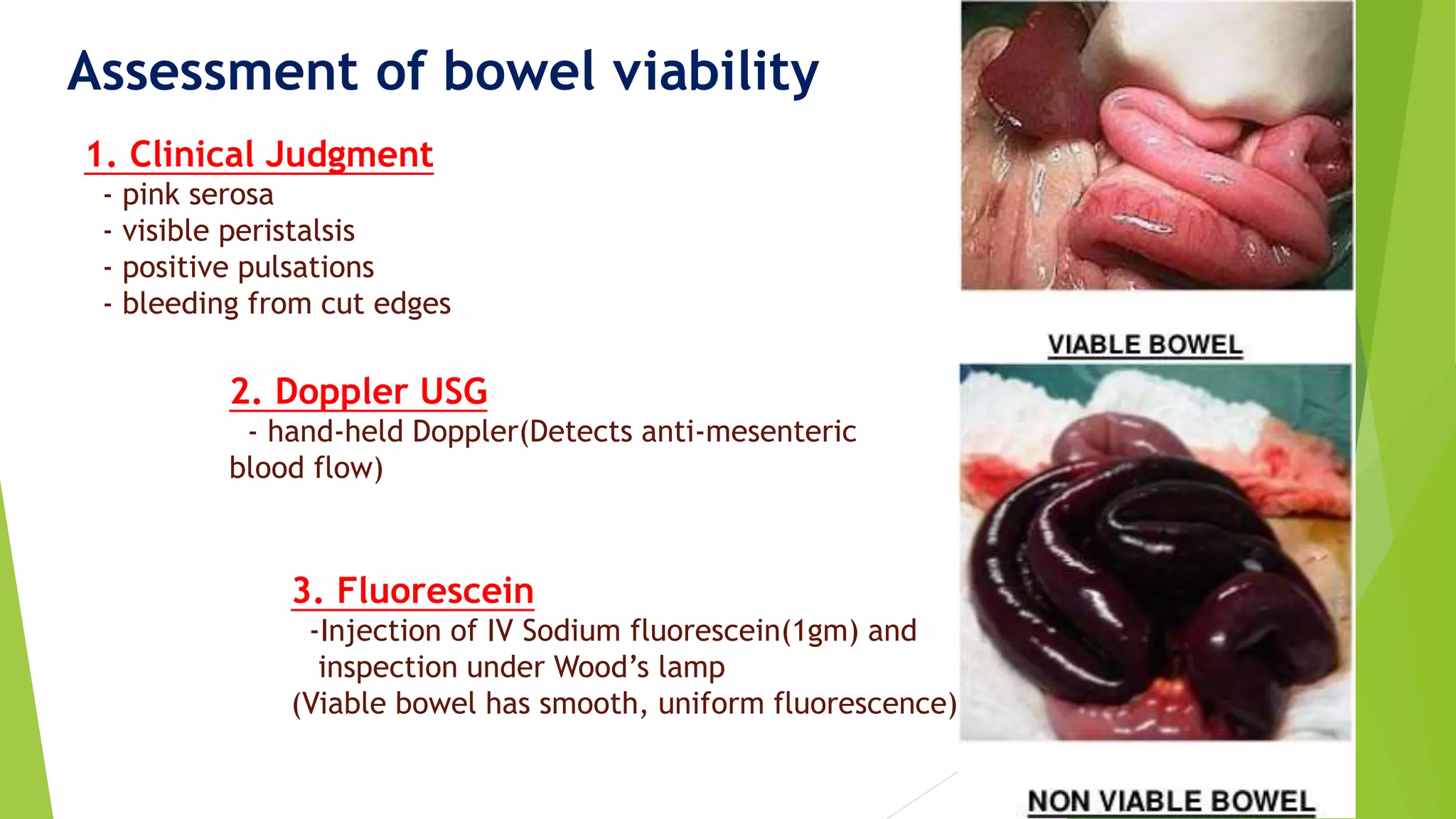 ACUTE MESENTERIC ISCHAEMIA | PPTX