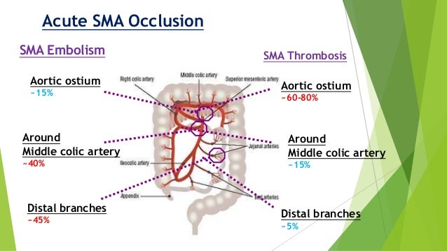 ACUTE MESENTERIC ISCHAEMIA