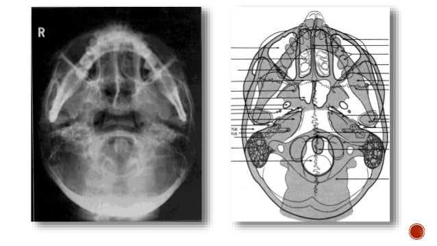 5. imagenologia de craneo y cara.pptx