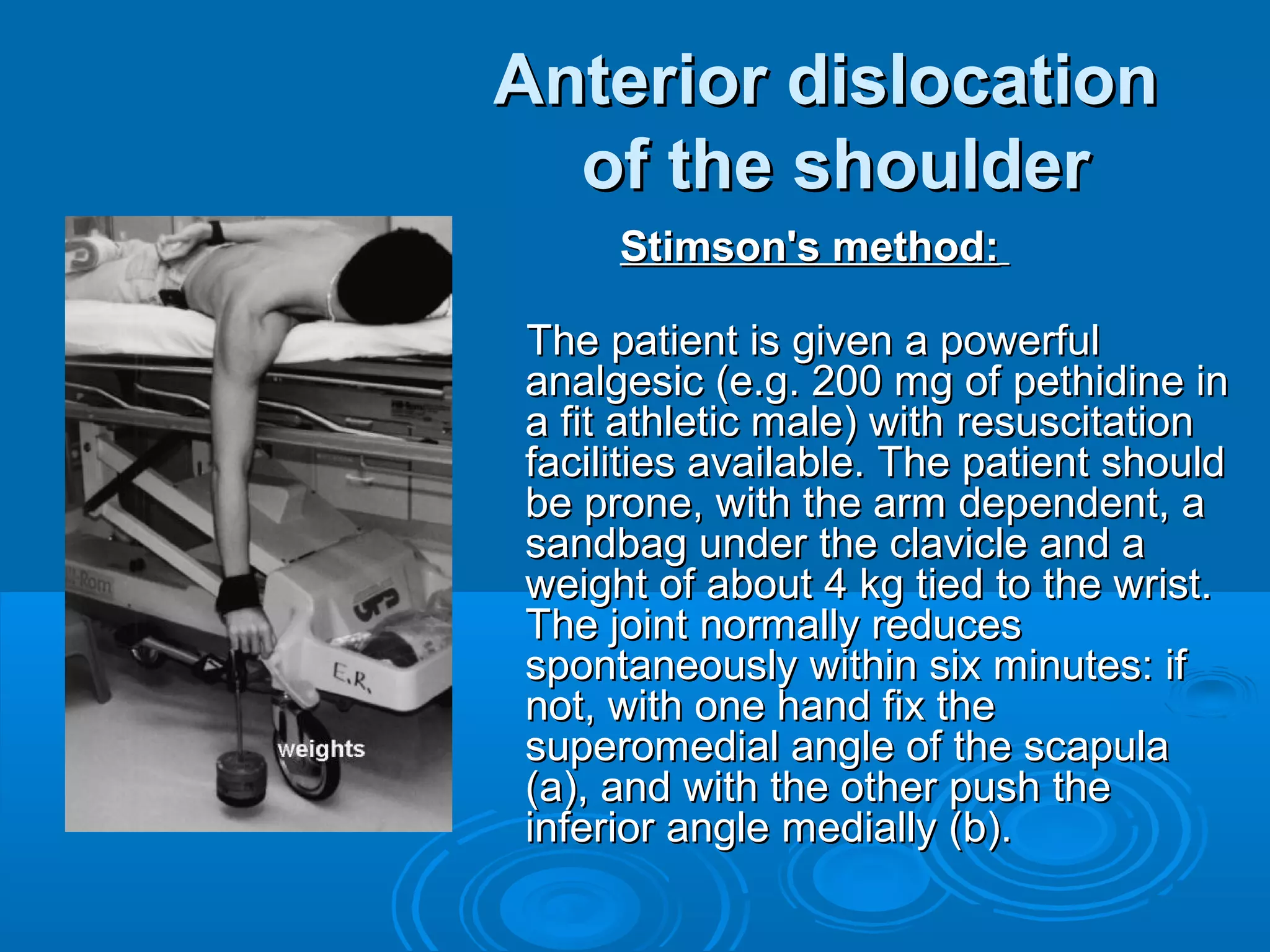 Fracture of Shoulder and Humerus | PPT
