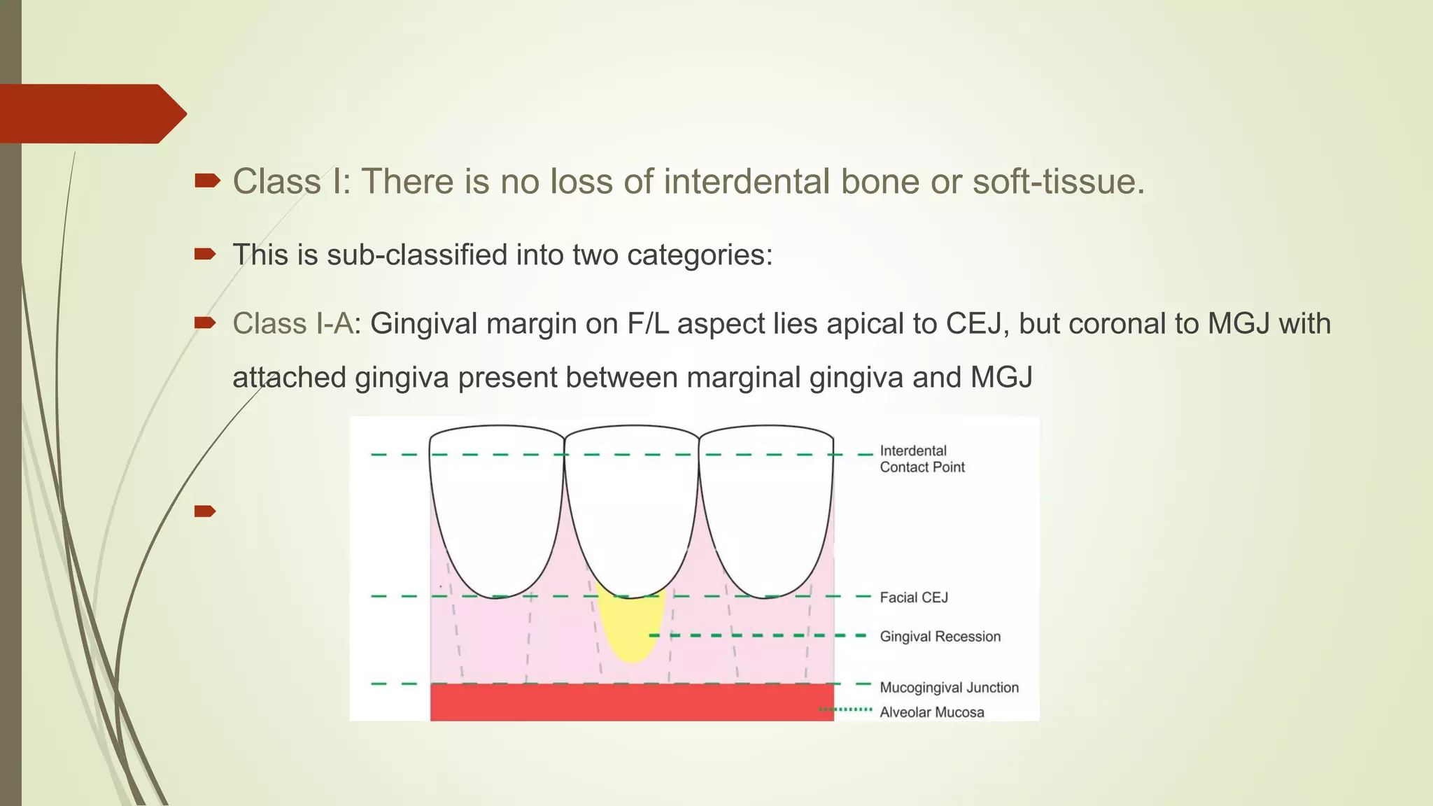 5.gingival recession seminar | PPTX