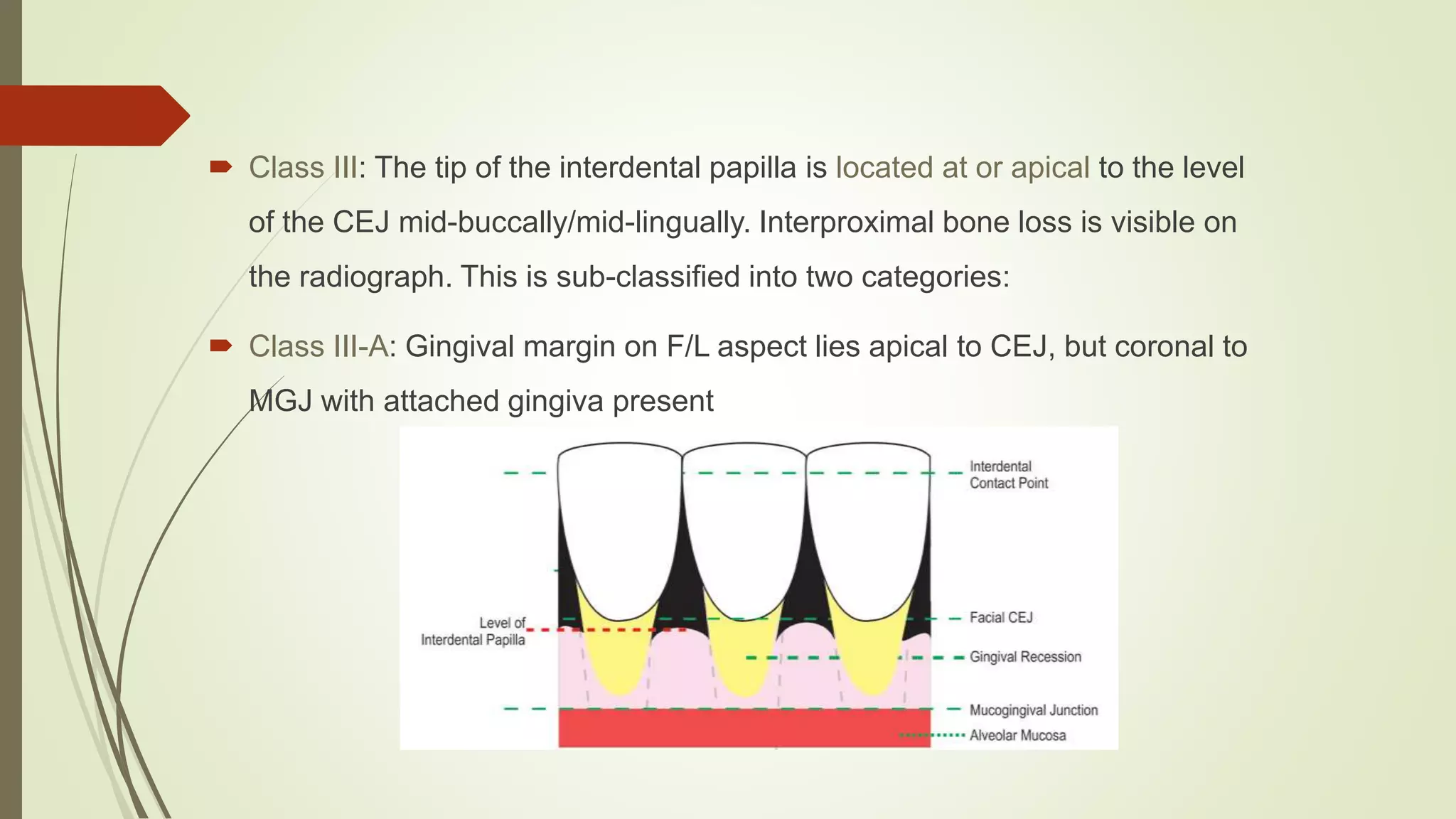 5.gingival recession seminar | PPTX