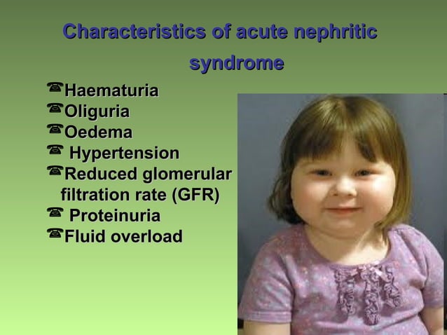 Glomerulonephritis in children | PPT