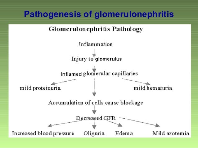 Glomerulonephritis in children