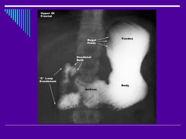 Radiological diagnostics of Gastro-Intestinal System | PPT | Digestive ...