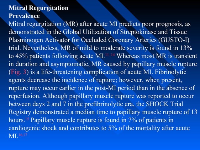 Complications of Myocardial Infarction (MI) | PPT | Heart and ...