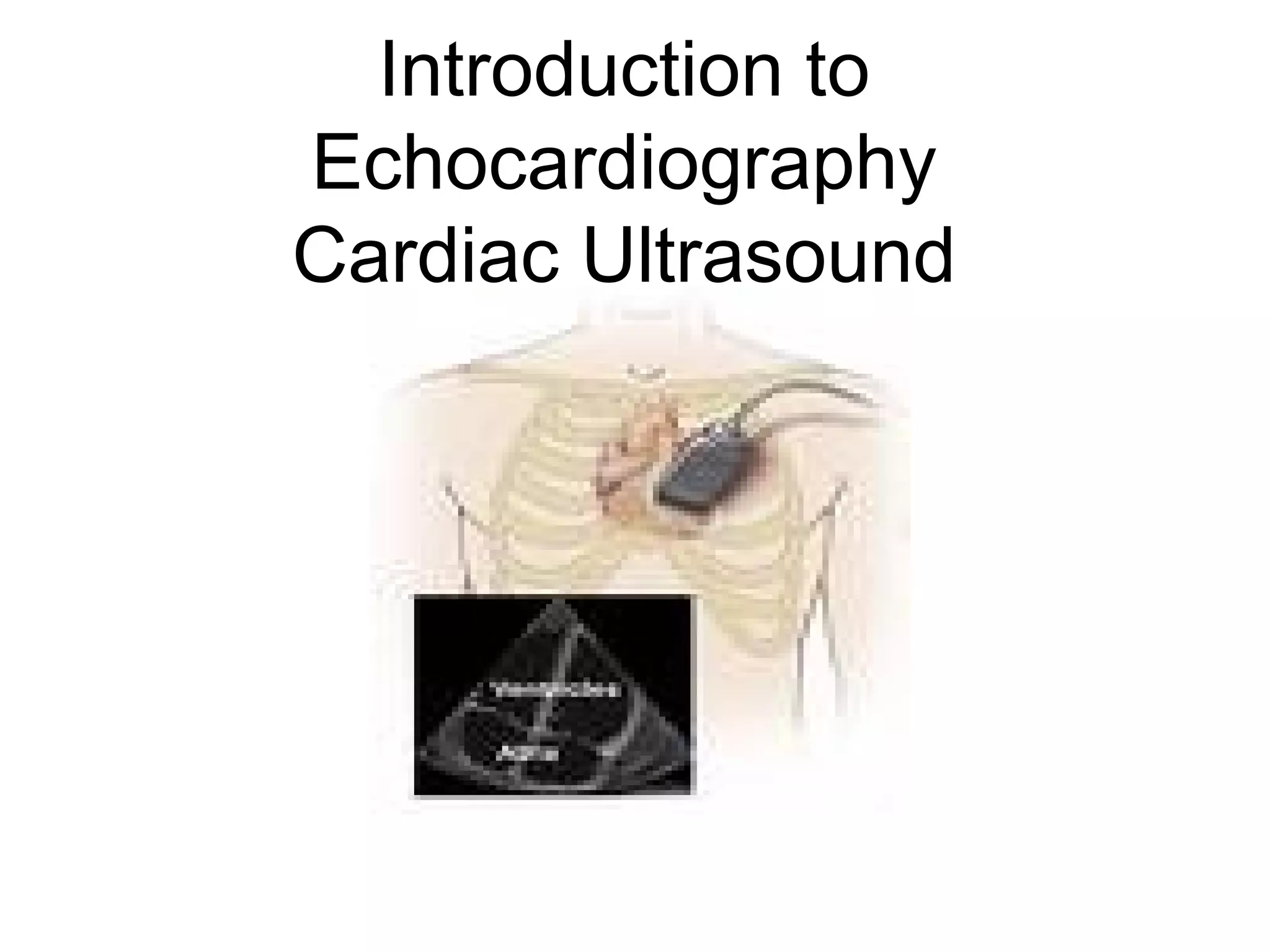 Echocardiography Cardiac Ultrasound | PPT