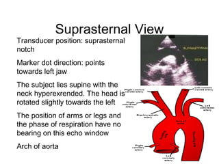 Echocardiography Cardiac Ultrasound | PPT