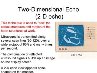 Echocardiography Cardiac Ultrasound | PPT