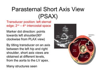 Echocardiography Cardiac Ultrasound | PPT