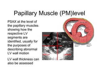 Echocardiography Cardiac Ultrasound | PPT