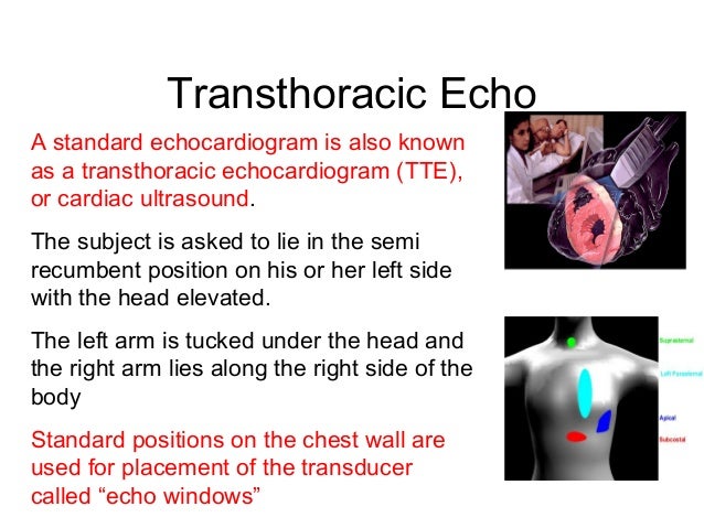 Echocardiography Cardiac Ultrasound